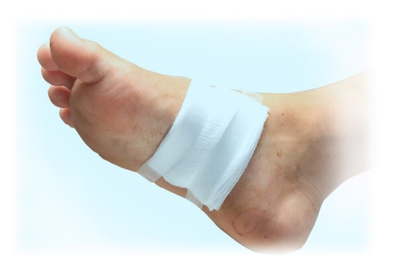 Unhealed Foot Wound | Washington Vascular