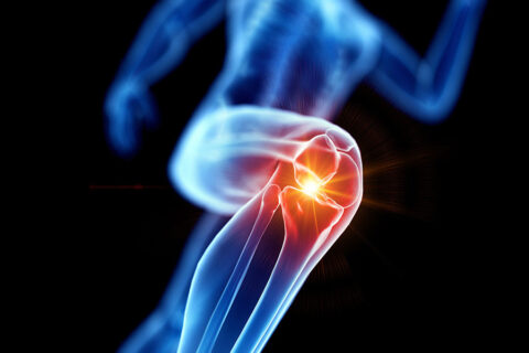 Genicular Artery Embolization Washington Vascular