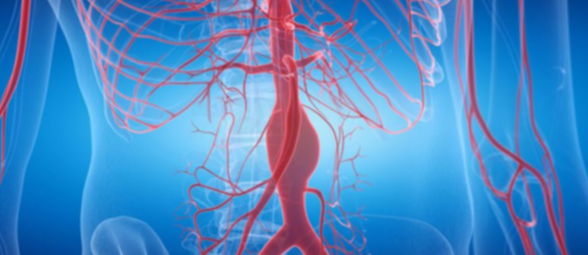Vascular Disease | Washington Vascular